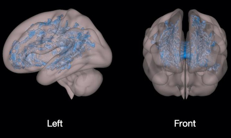 PILDID: Kuidas mõjub lapse ajule lugemine, kuidas aga ekraanide ...